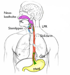 Stemproblemen en reflux (NL) – Singing from the Inside Out